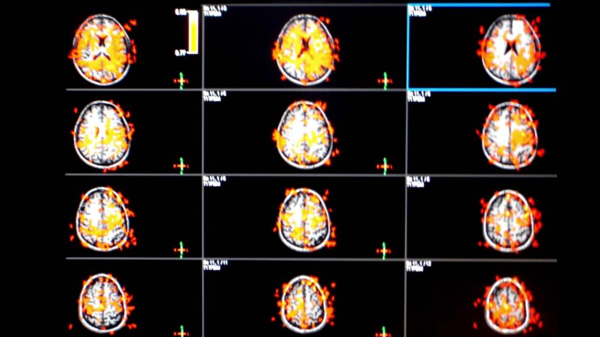 Exceptional experience in a MRI